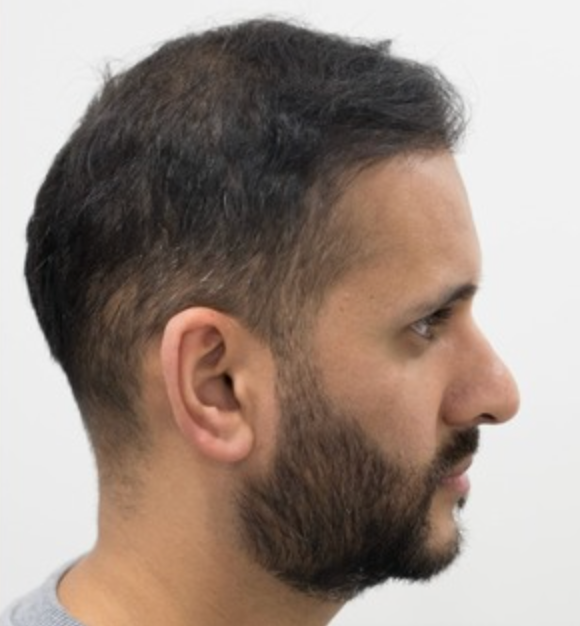 Vortex Comb Bundle – UK Vortex