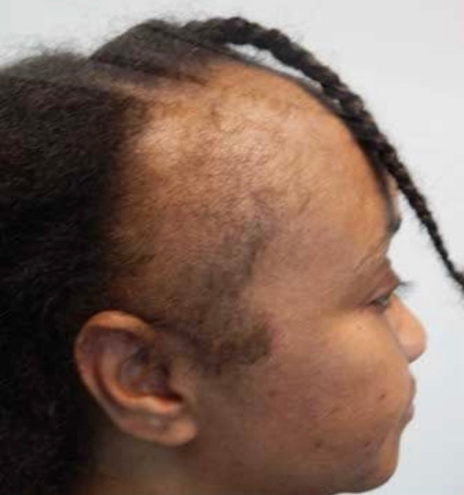 Vortex Comb Bundle – UK Vortex